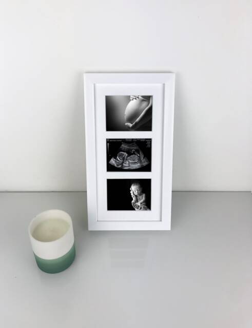 Ultrasound Baby Scan Photo Frame - 3 Aperture Pregnancy Print Picture ...