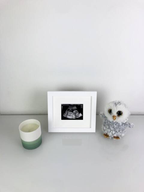 Baby Scan Photo Frame - Ultrasound Sonogram 12 & 20 Week Pregnancy ...
