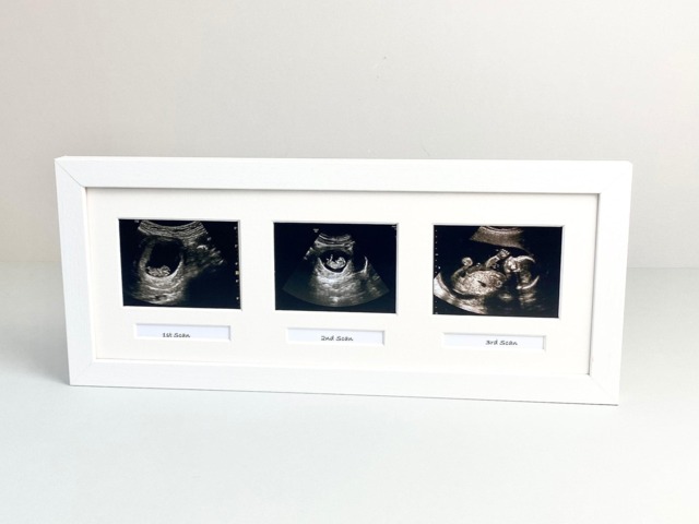 Baby Scan Photo Frame - Multi Aperture For Three Sized Photos & Text ...