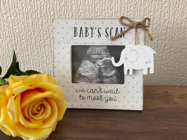 Baby Scan Picture Frame Ultrasound Photo Baby Picture Keepsake Frame ...