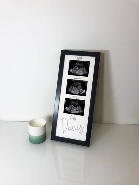 Personalised Ultrasound Baby Scan Print 3 Aperture Pregnancy Photo ...