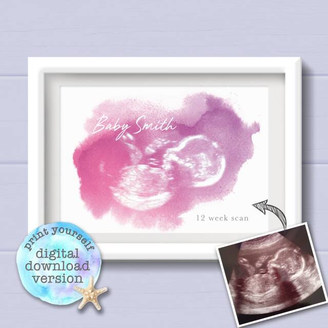 Personalised Watercolour Baby Scan. Digital Download To Print Yourself ...