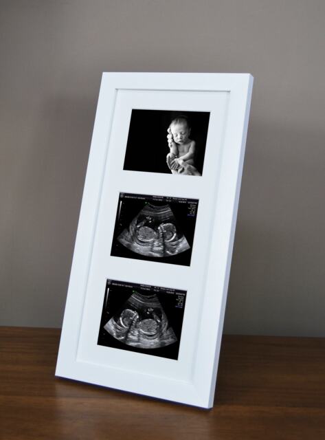 Ultrasound Baby Scan Photo Frame - 3 Aperture Pregnancy Picture Print ...