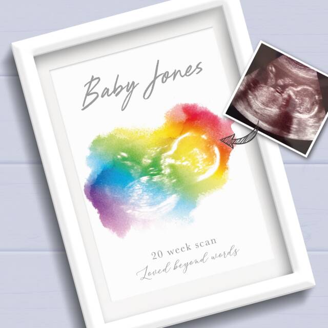 Rainbow Baby Scan Print. Ultrasound Or Sonogram Art Baby Scan Keepsake ...