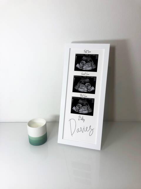 Personalised Ultrasound Baby Scan Photo Frame - 3 Aperture Pregnancy ...