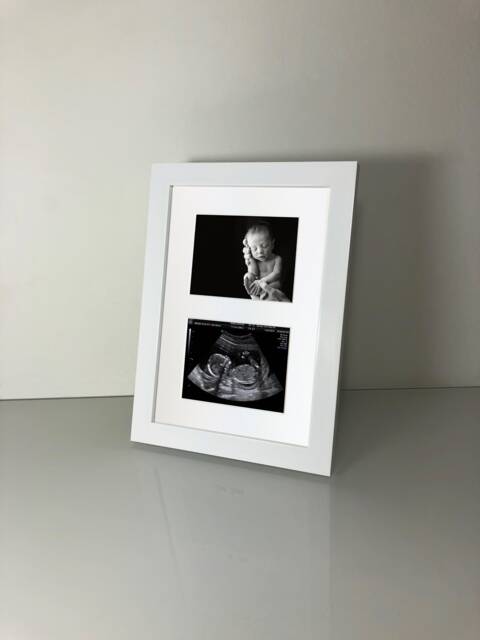 Baby Scan Picture Frame - 2 Aperture Ultrasound Sonogram 12 & 20 Week ...