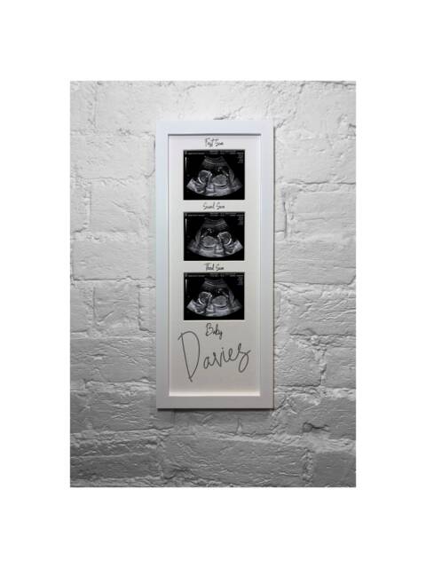 Personalised Ultrasound Baby Scan Photo Frame - 3 Aperture Pregnancy ...