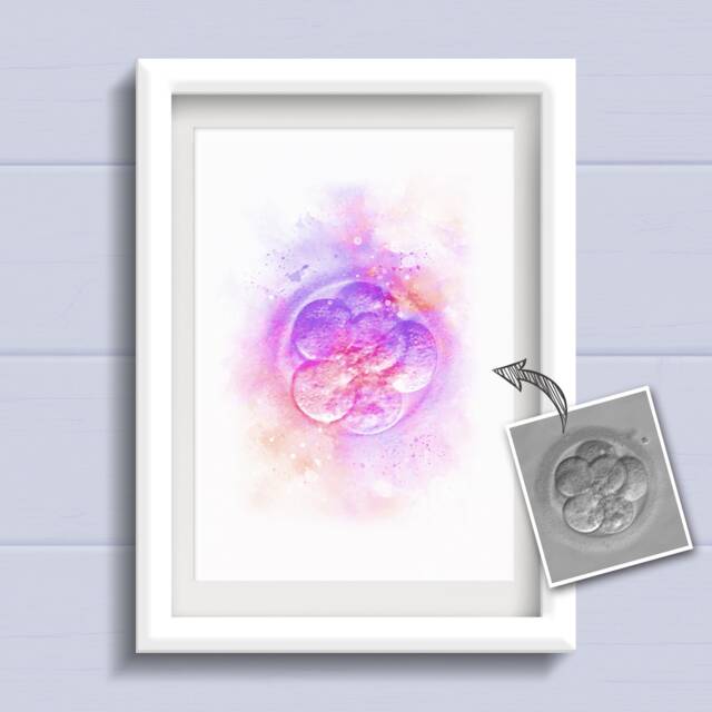 Ivf Embryo Art Print, Personalised Watercolour Style Nursery Decor ...