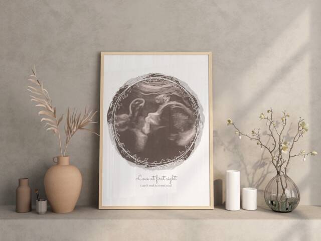 Baby Scan Print - Ultrasound Photo Pregnancy Announcement Shower Gift ...