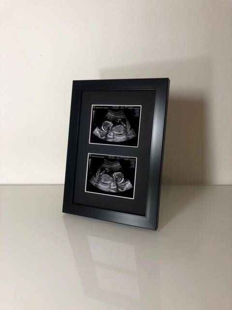 Baby Scan Photo Frame - Handmade 2 Aperture 12 & 20 Week Ultrasound ...
