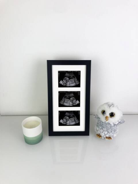Ultrasound Baby Triple Scan Print 3 Aperture Pregnancy Picture Photo ...