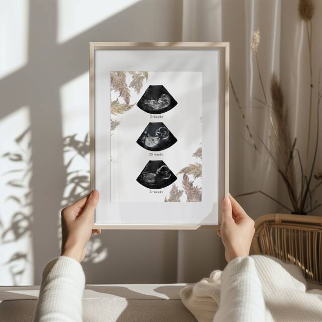 Multiple Baby Scan Frame/ Pregnancy Announcement /Ultra Sound - Gift ...